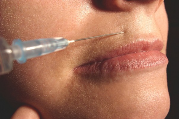 Facial Filler Ups . . . and Downs | My Little Bird