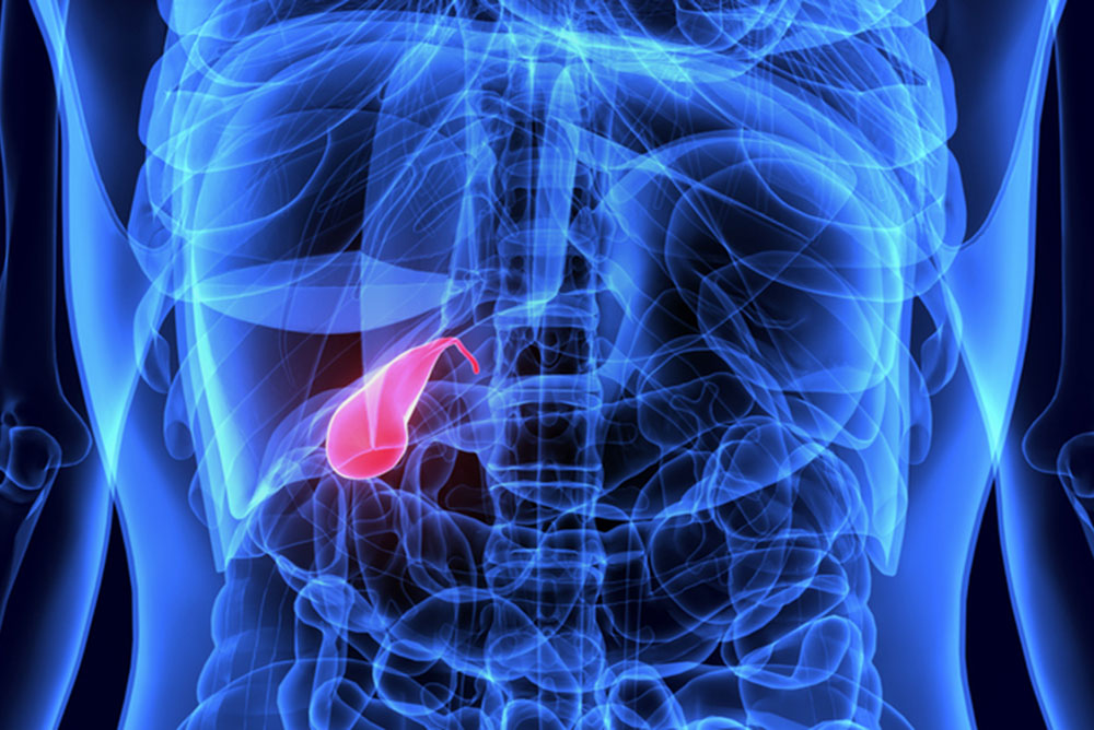 Gallbladder Disease Or IBS My Little Bird Gallbladder Disease Or IBS My Little Bird
